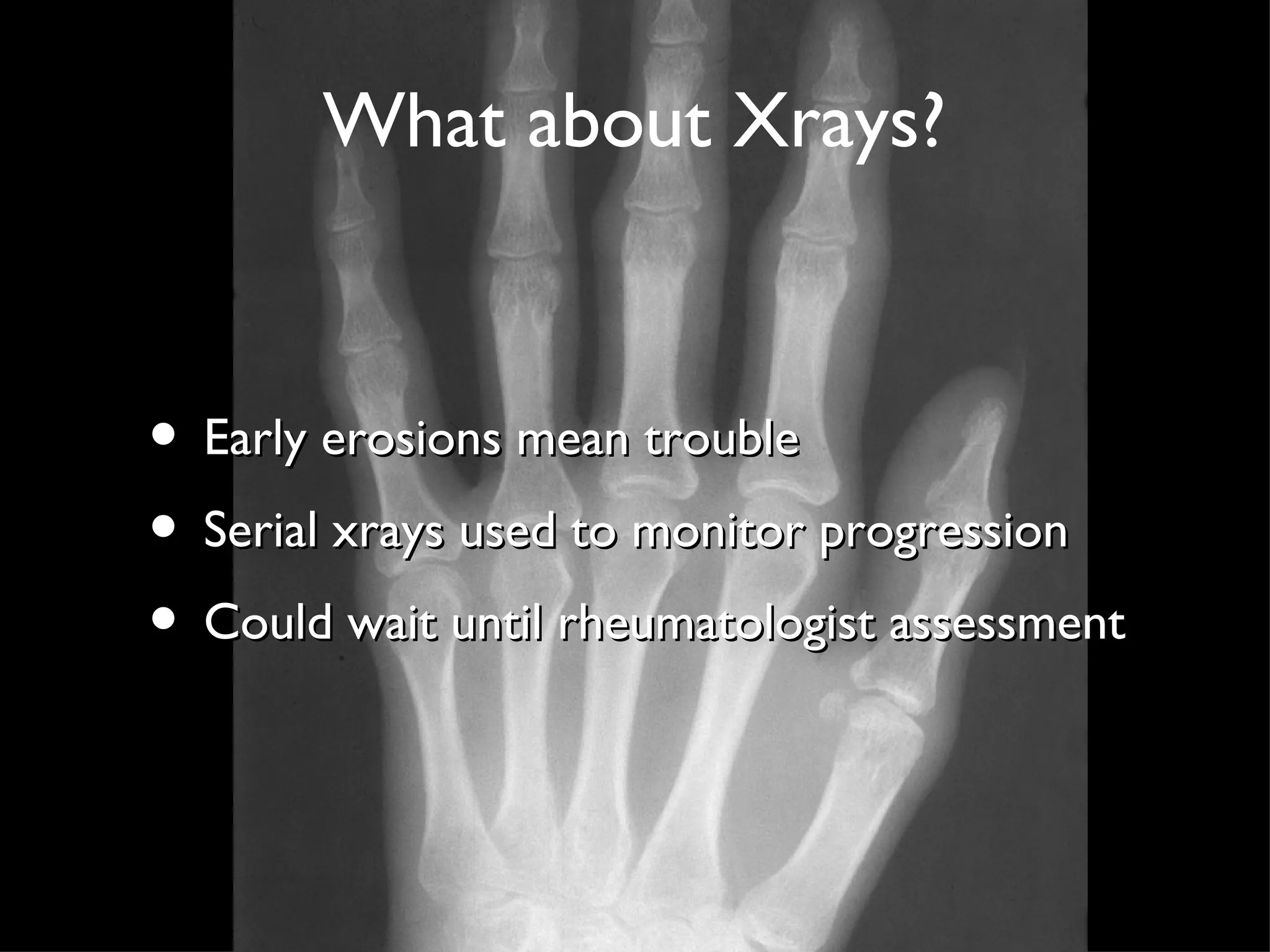 Inflammatory arthritis; a quick run through. | PPT