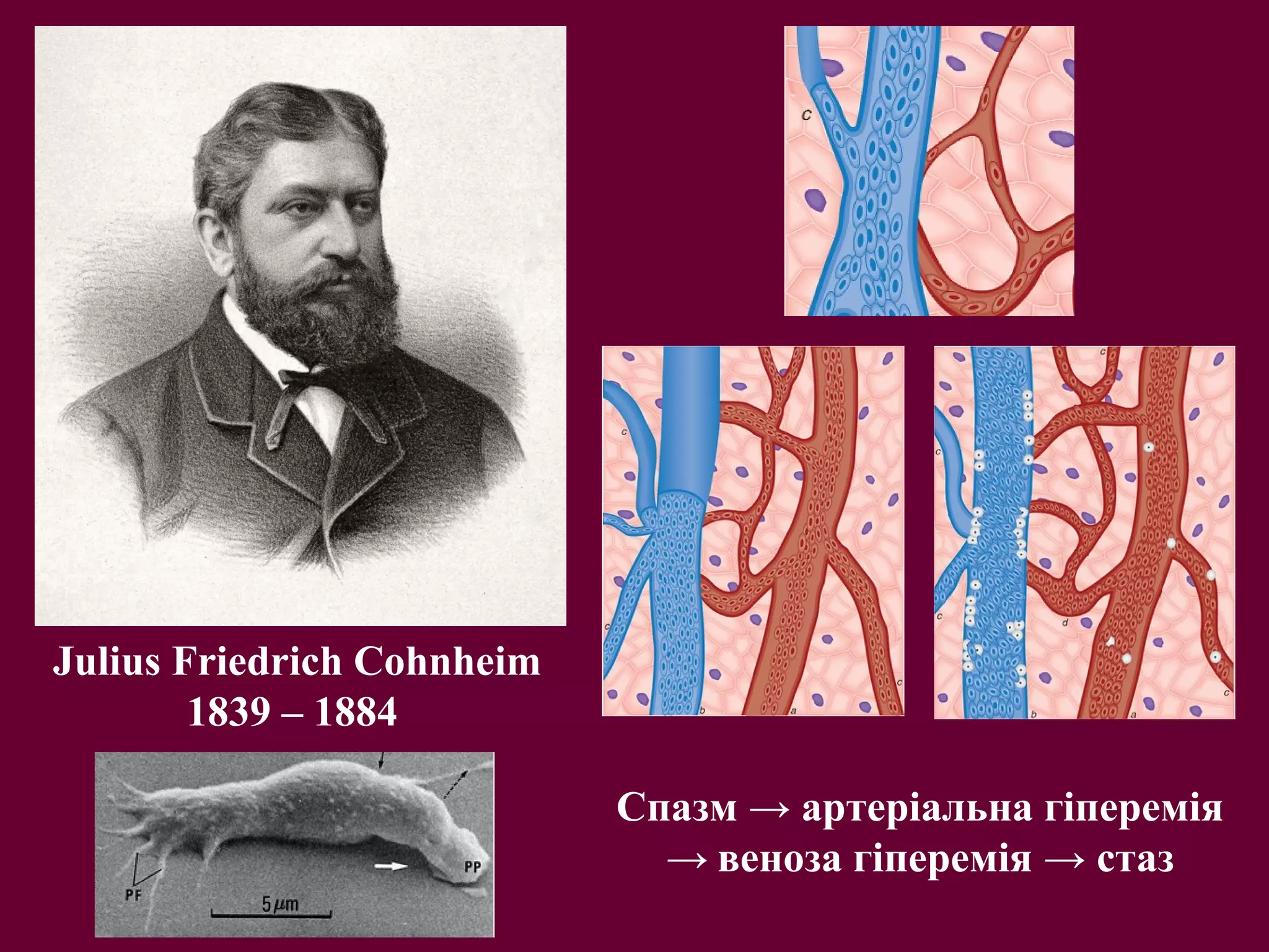 Запалення: гуморальні механізми | PPT