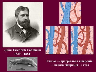 Запалення: гуморальні механізми | PPT