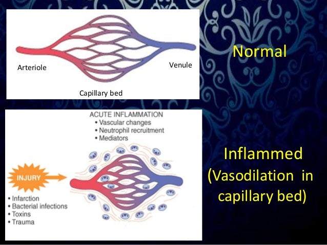 Inflammation by Dr. Amit T. Suryawanshi, Oral Surgeon, Pune