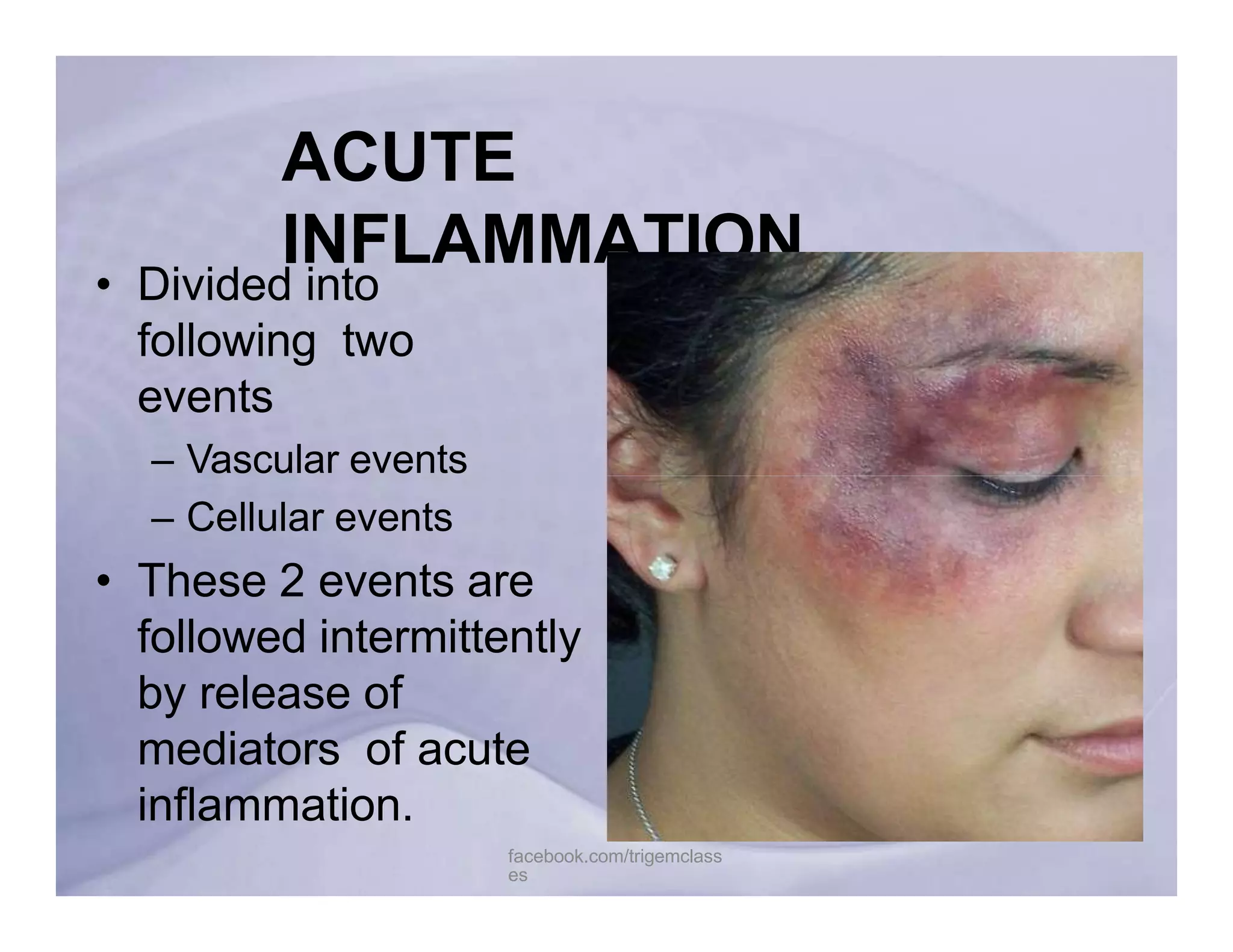 inflammation-150818185203-lva1-app6891-converted.pptx