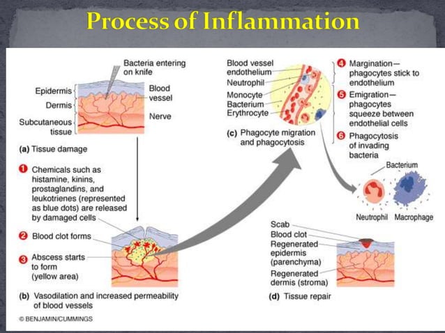 Inflammation: Introduction | PPTX