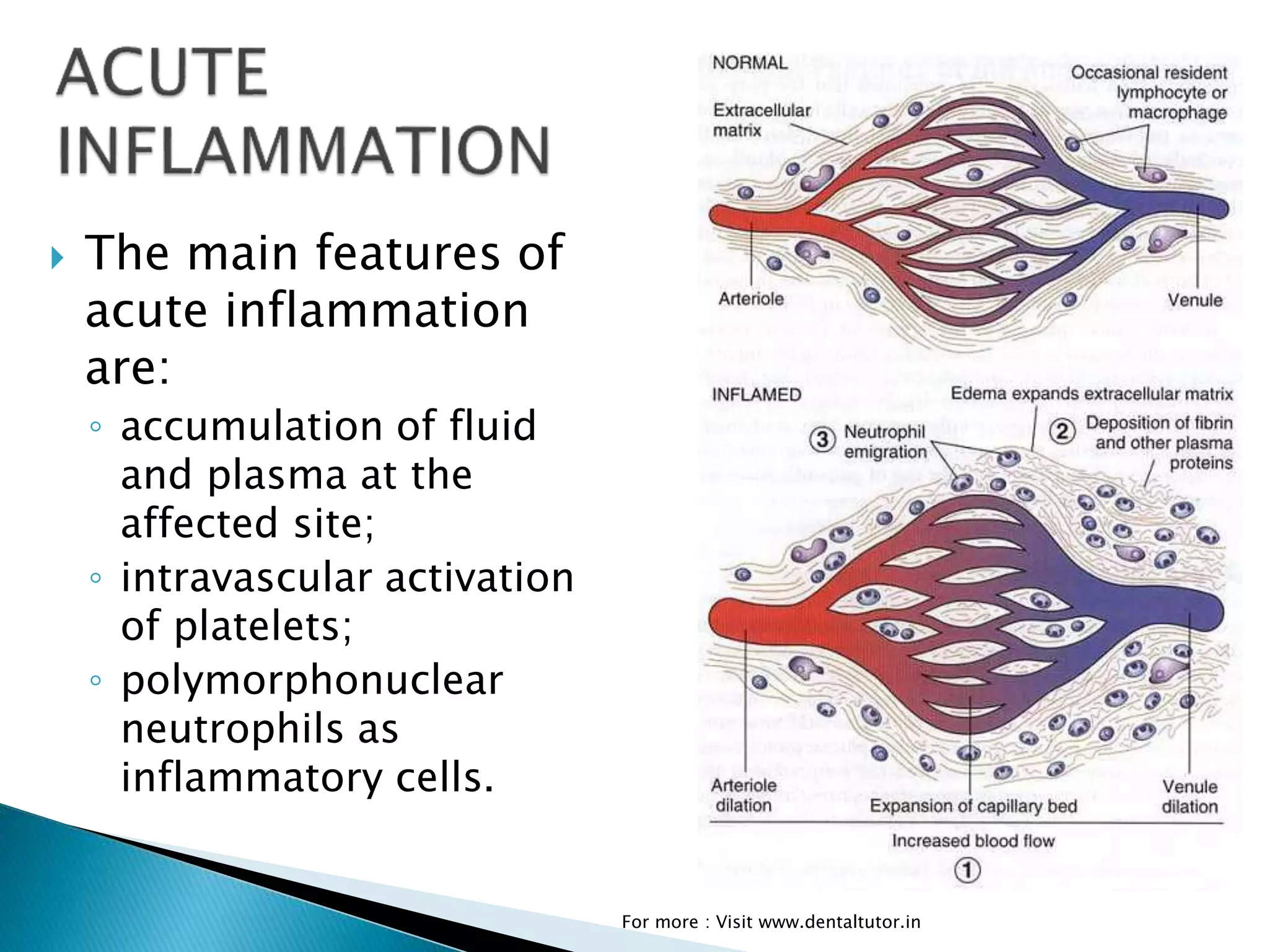 Inflammation | PPTX