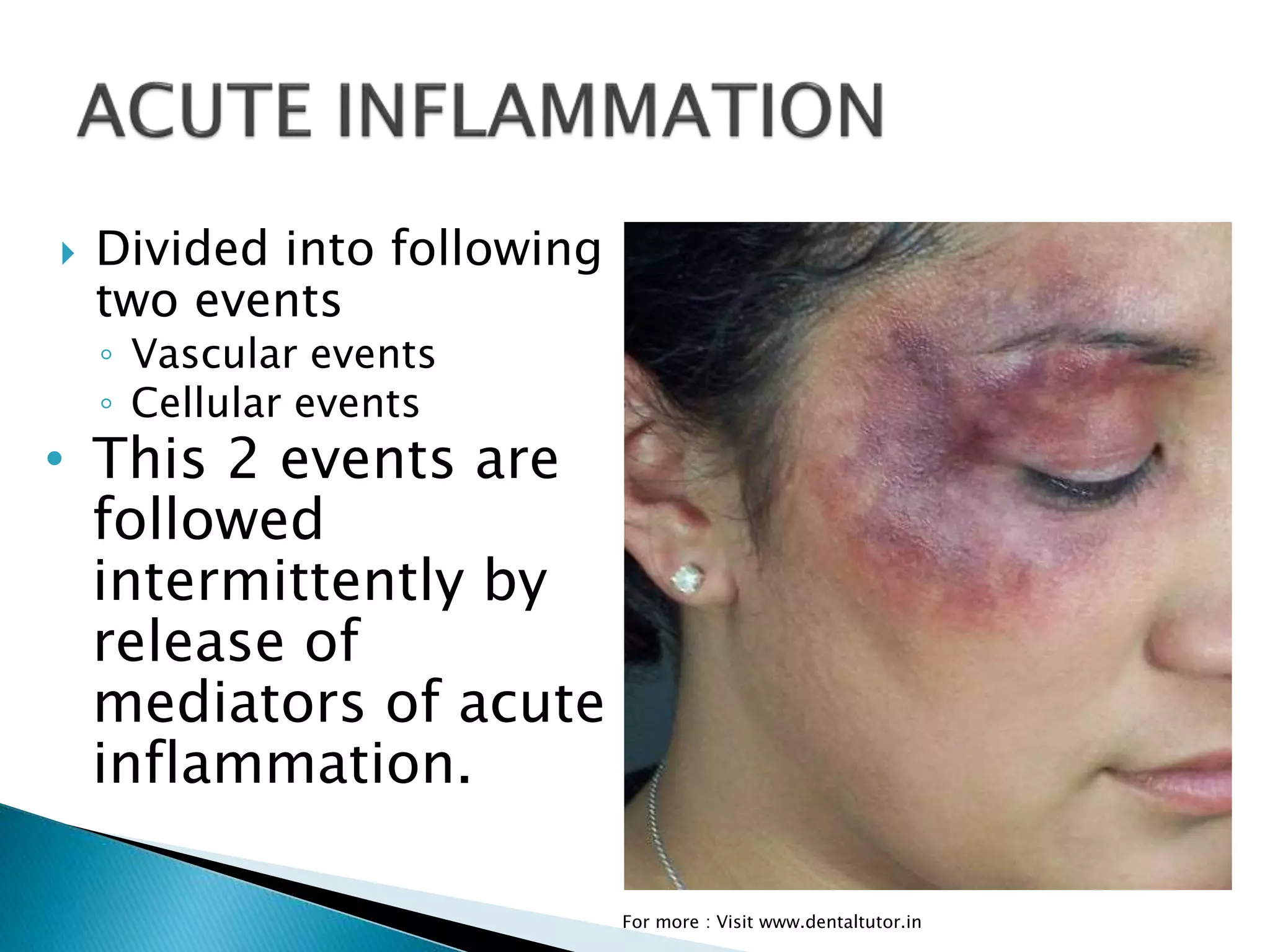 Inflammation | PPTX