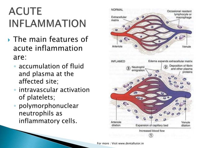 Inflammation | PPTX | Blood Disorders | Diseases and Conditions