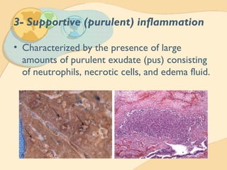 Inflammation | PPT