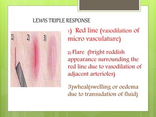 Inflammation and wound healing | PPTX