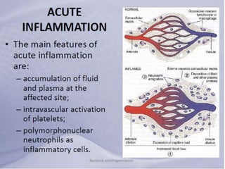 Inflammation - pathophysiology (PHARM D) | PPTX