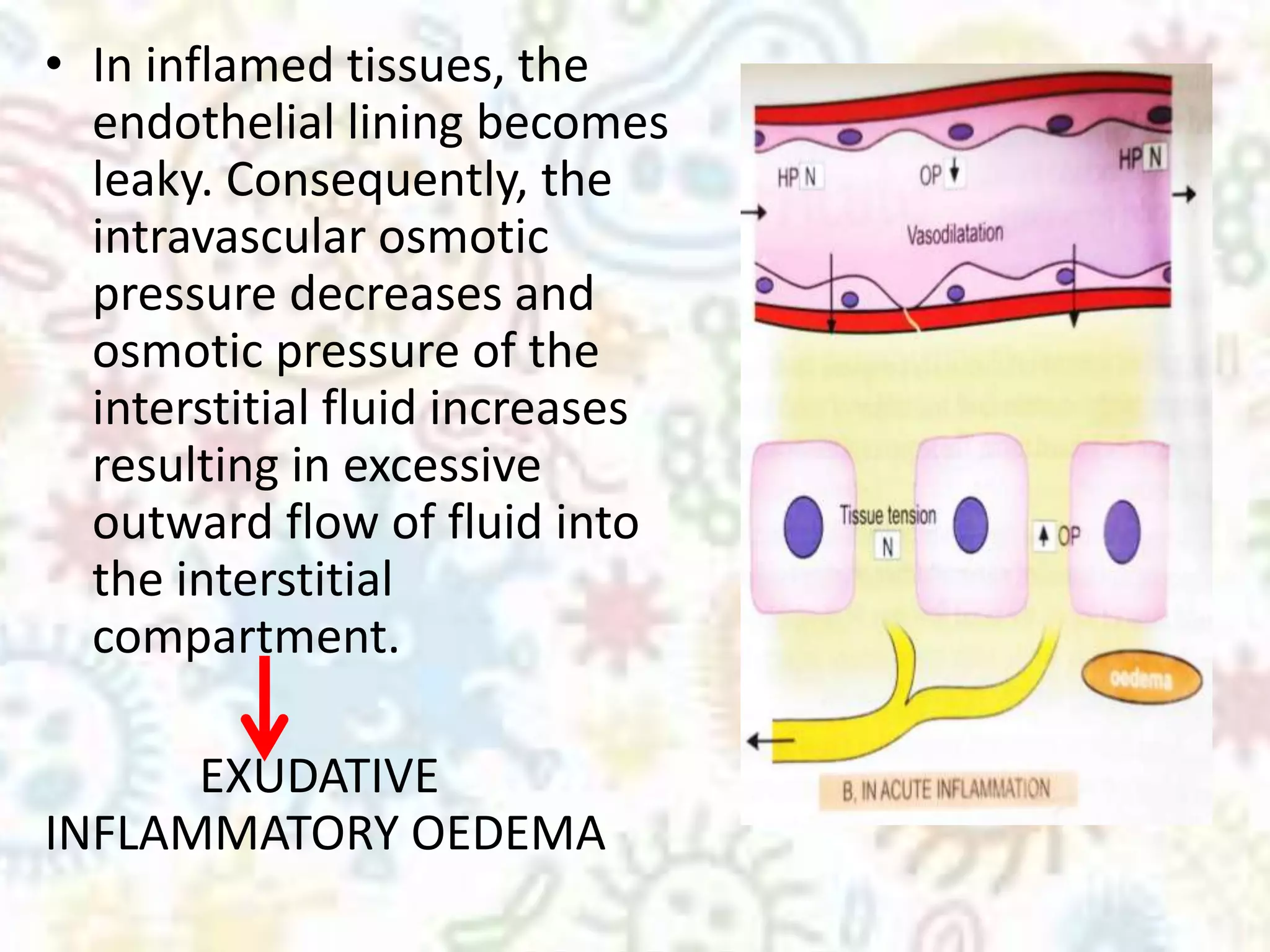 Inflammation- General Pathology seminar PG 1st year | PPTX