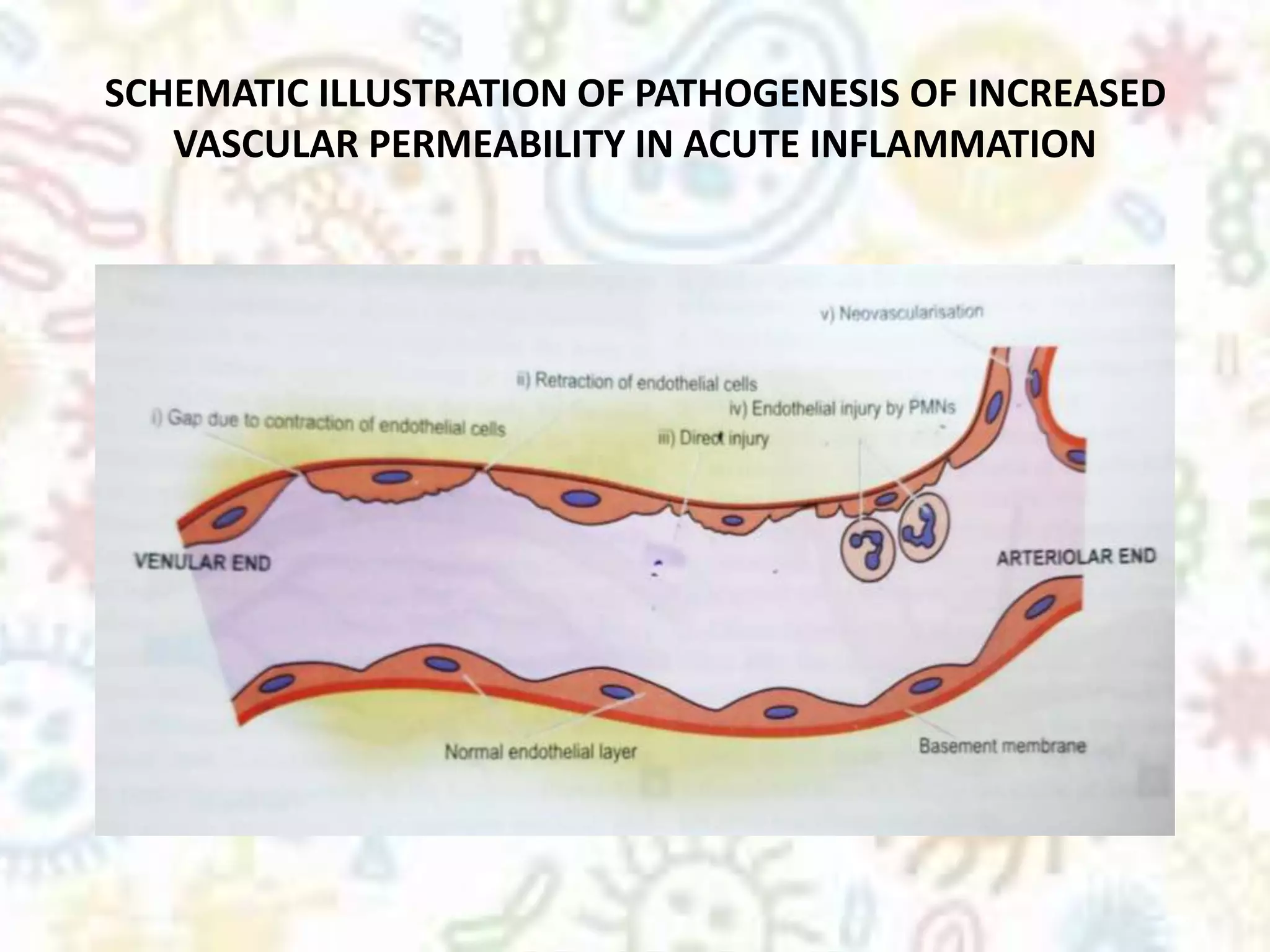 Inflammation- General Pathology seminar PG 1st year | PPTX