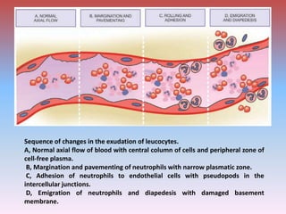 Inflammation- Basic Concept | PPTX