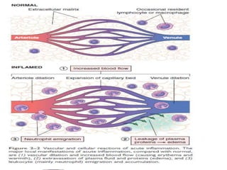 Inflammation | PPTX