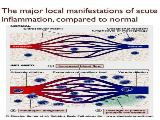 Inflammation | PPTX | Blood Disorders | Diseases and Conditions