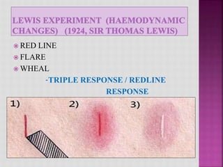 Inflammation | PPTX