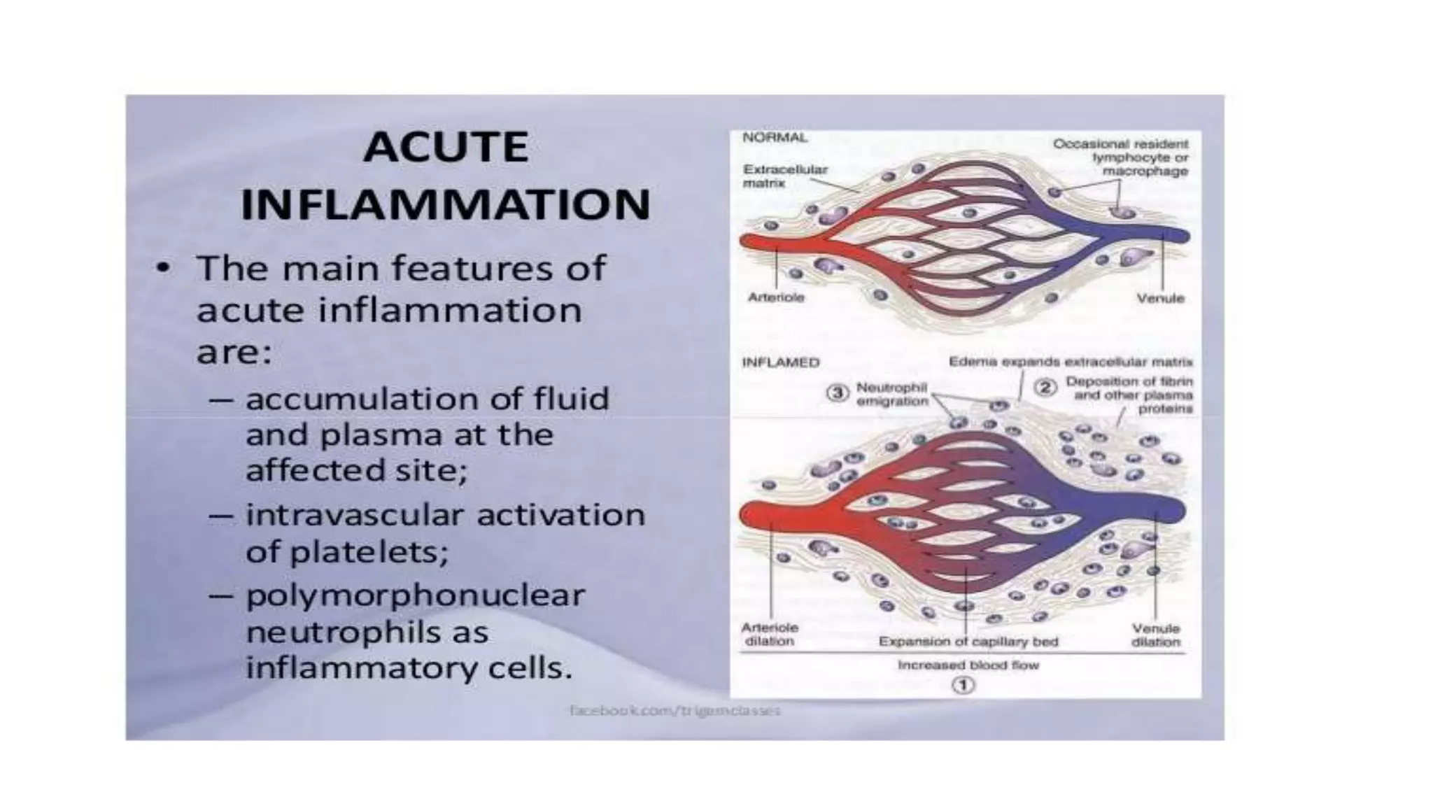 Pathophysiology of Inflammation | PPTX