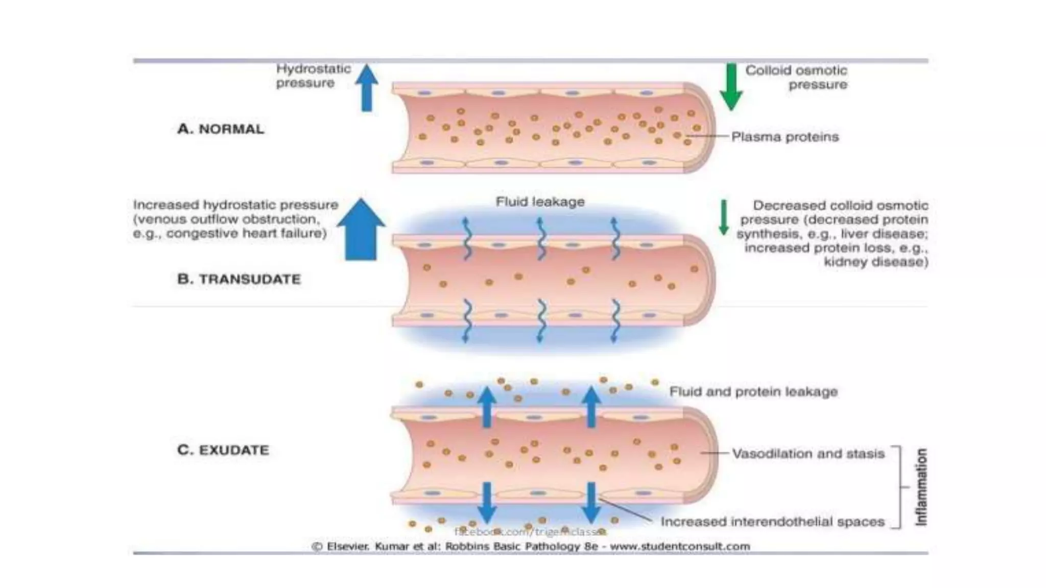 Pathophysiology of Inflammation | PPTX