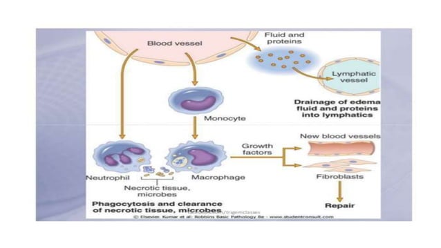 Pathophysiology of Inflammation | PPTX | Diseases and Conditions ...