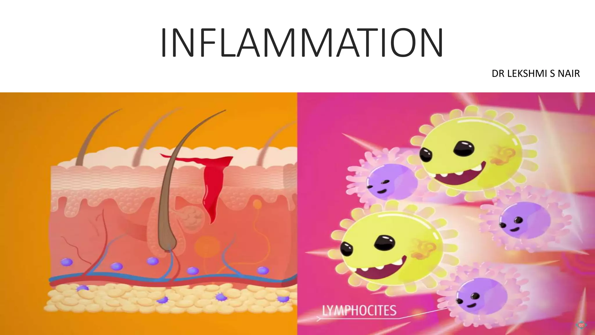Inflammation | PPTX