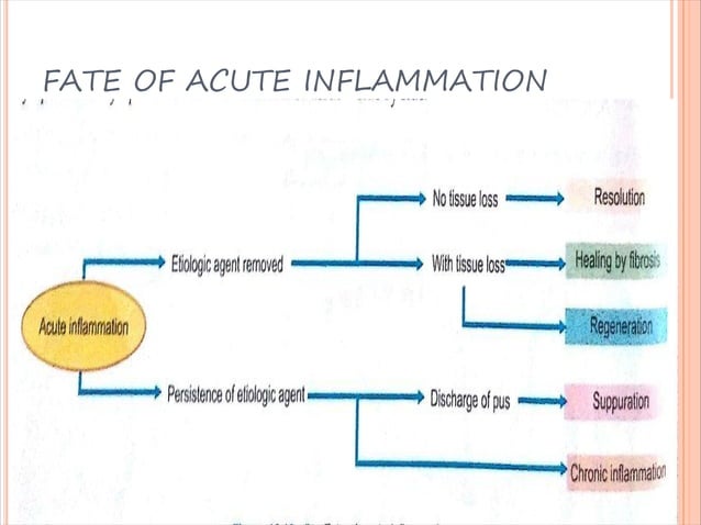inflammation.pdf
