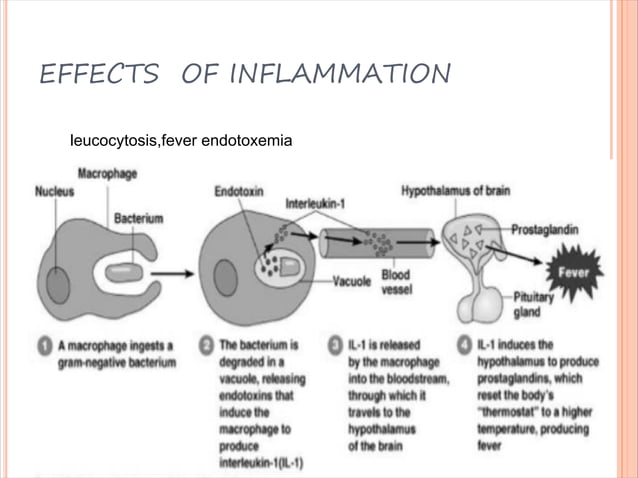 inflammation.pdf