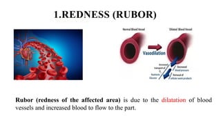 INFLAMMATION - common terms and full description.pptx