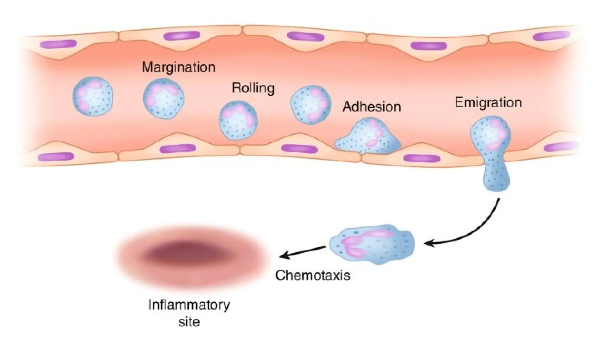 Acute inflammation – Short-term, immedia | PPTX