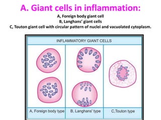 INFLAMMATION: Lecture - 3 | PPTX