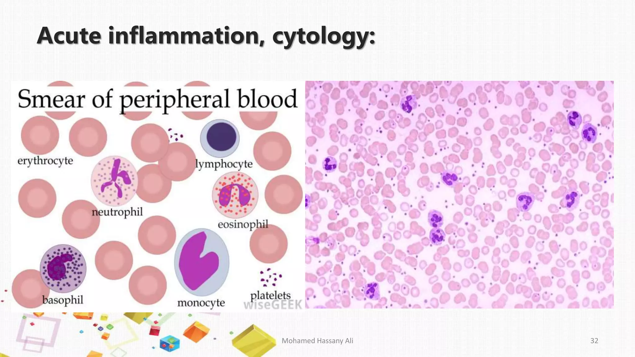 Inflammation acute inflammation | PPT