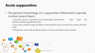 Inflammation acute inflammation | PPTX