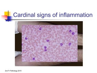 Inflammation-and-repair-lecture.ppt