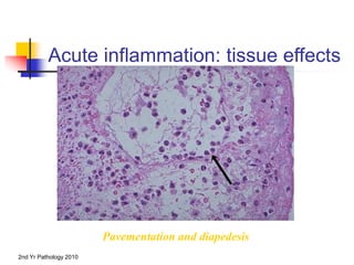 Diapedesis Histology