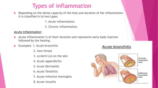 Inflammation lecture 4 | PPT