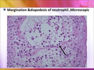 Diapedesis Histology