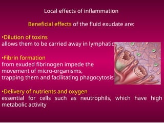 inflammation 1.ppt defending response , typical pathological process | PPT