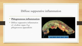 Inflammation 4 - inflammation pathology lecture series | PDF
