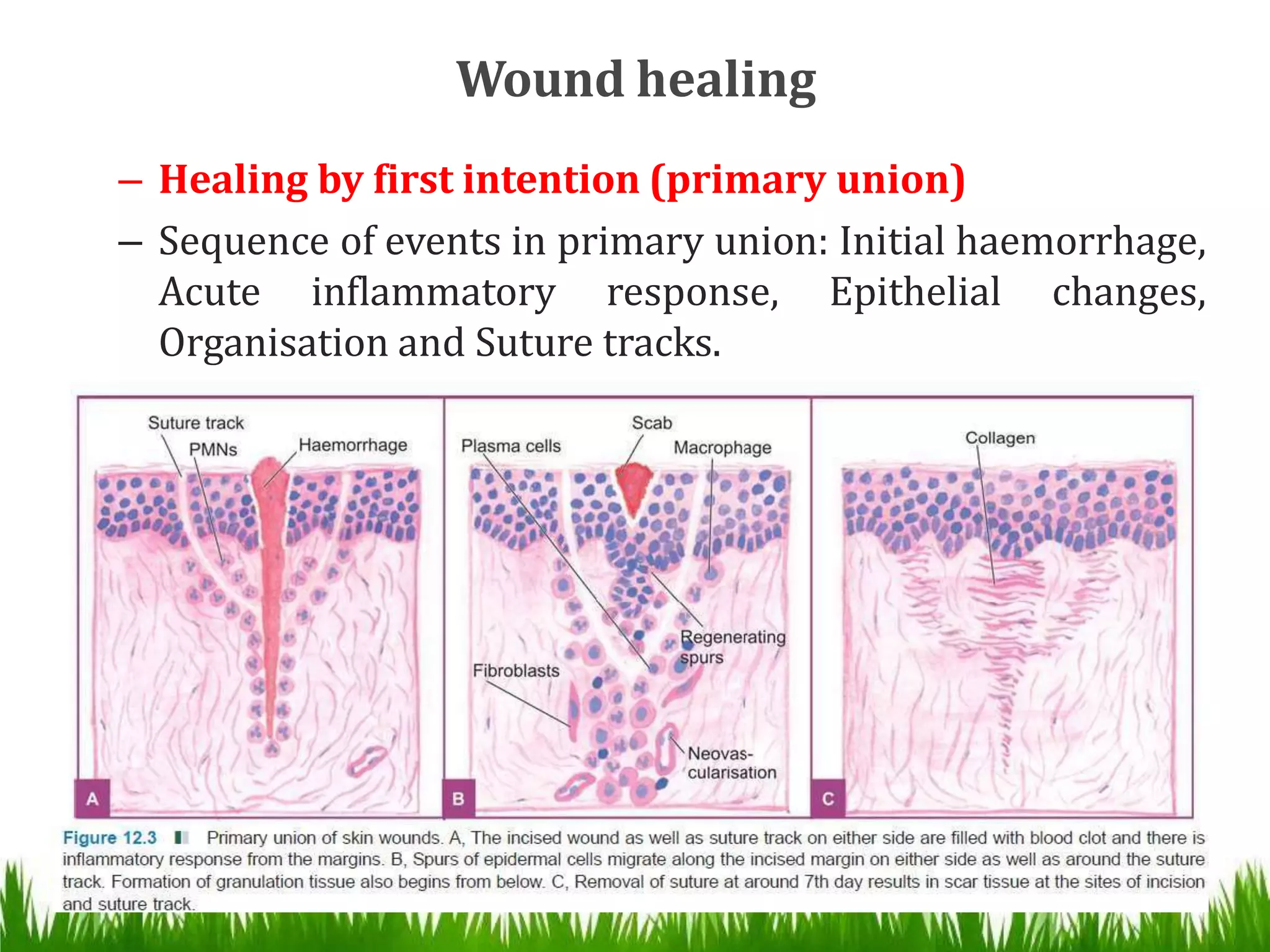 Inflammation and repair | PPTX