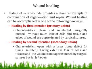 Inflammation and repair | PPTX