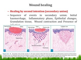 Inflammation and repair | PPTX