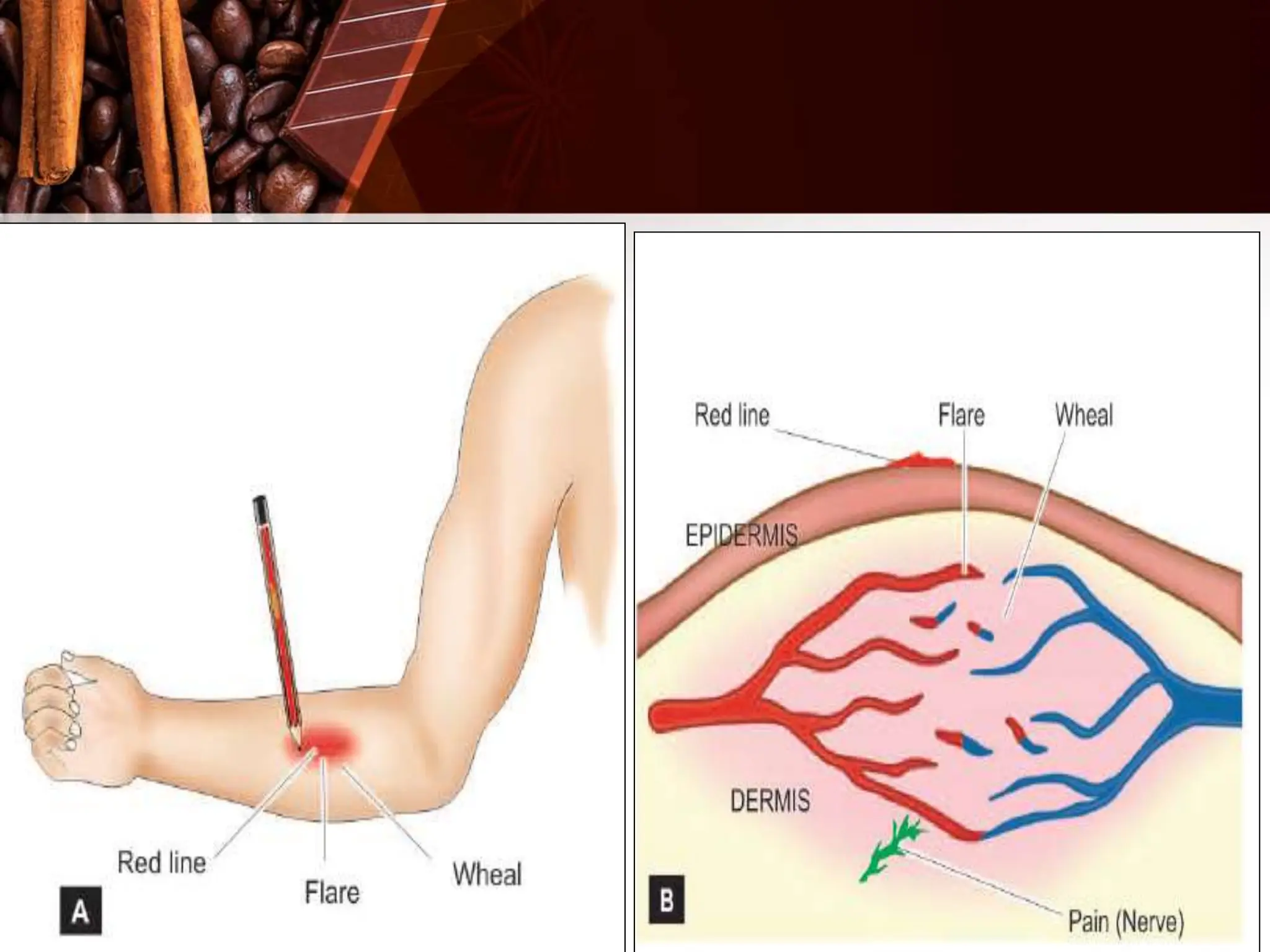 Inflammation and tissue Repair.pptx cell injury | PPTX