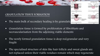 Inflammation and wound healing | PPTX