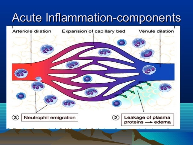 Inflammation