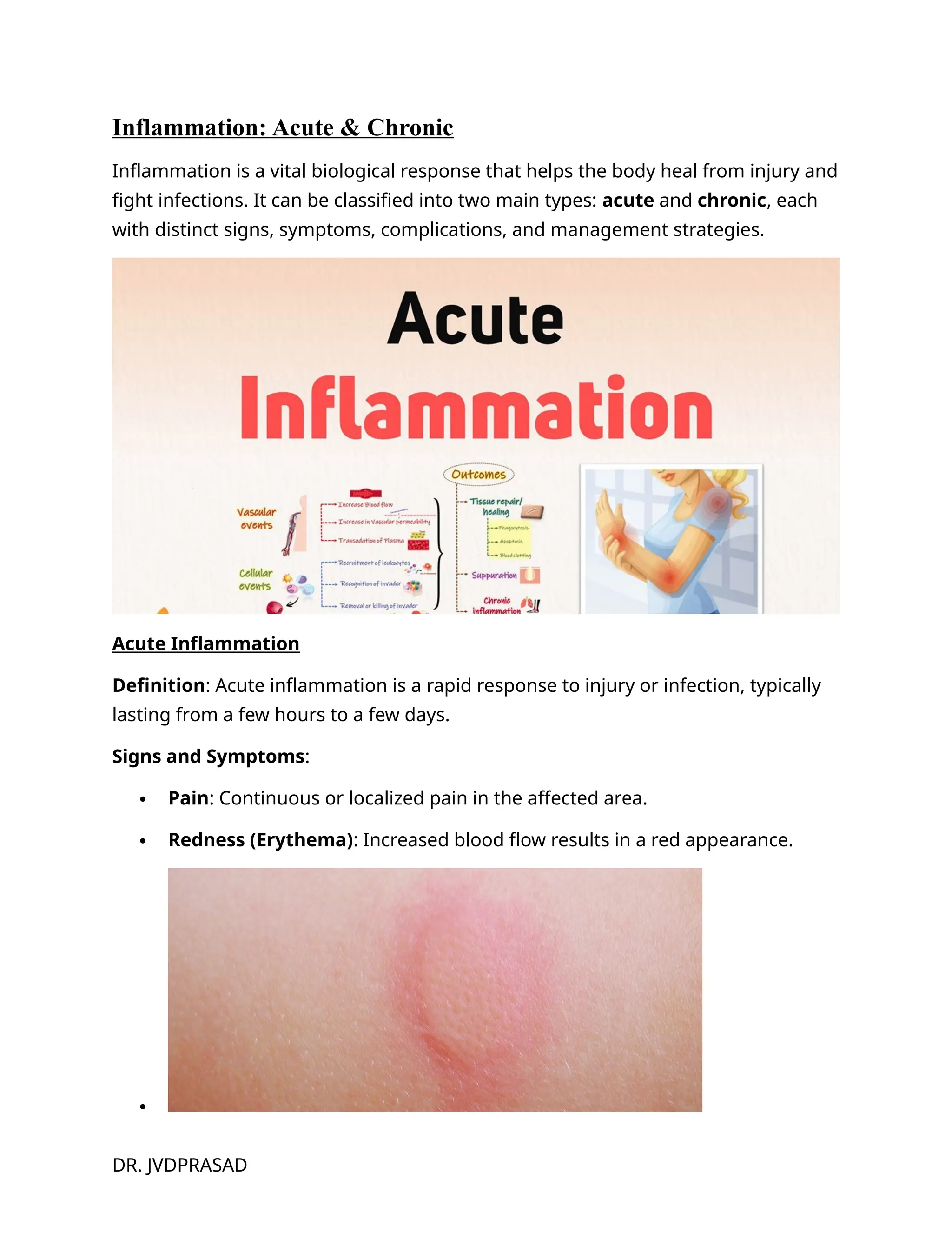 Inflammation - general surgery DR.Jvdprasad.docx