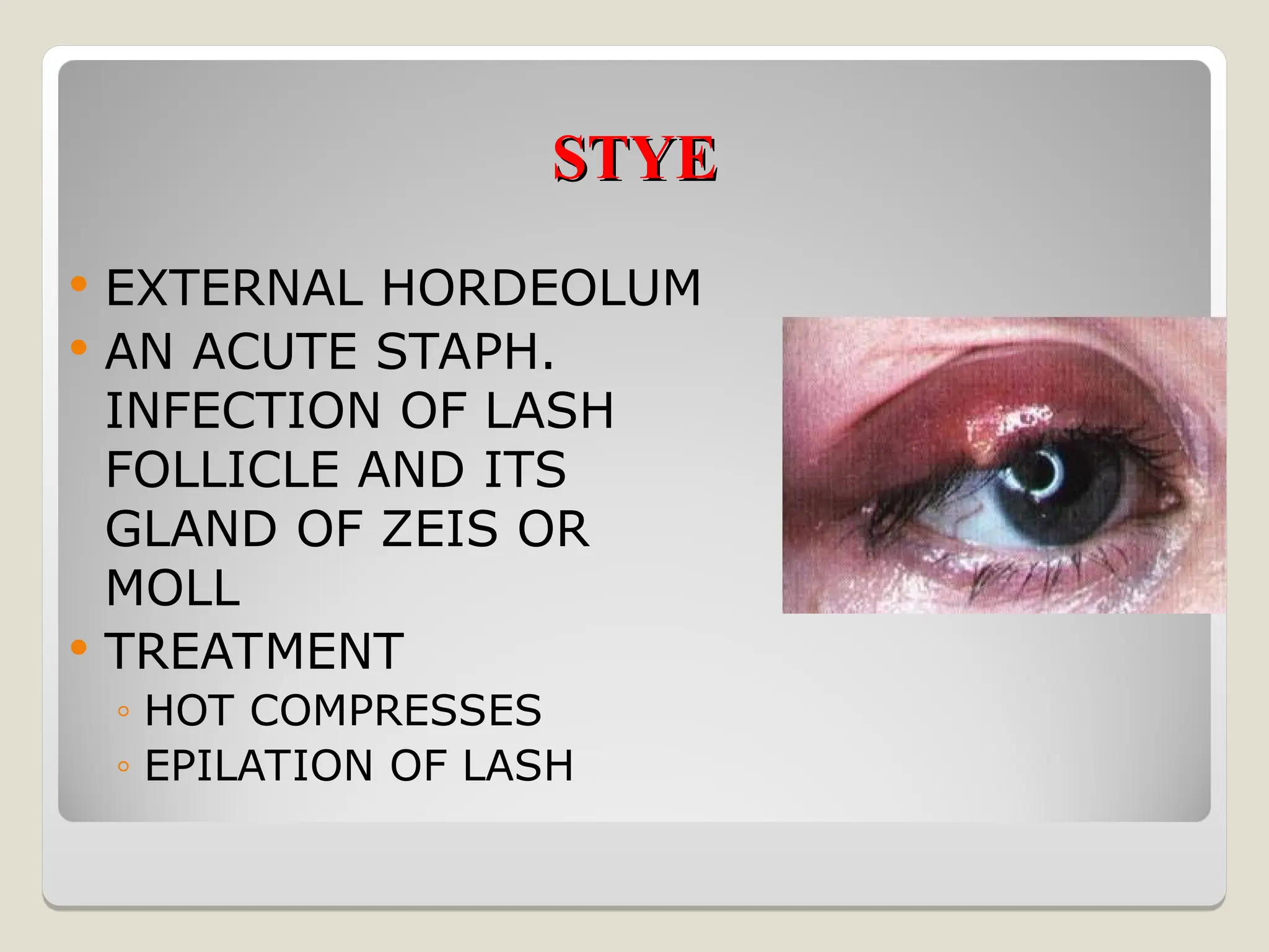 INFLAMMATION & INFECTIONS OF EYELIDS.ppt