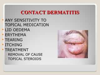 INFLAMMATION & INFECTIONS OF EYELIDS.ppt