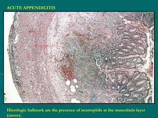 Inflammation Lab Slides | PPT