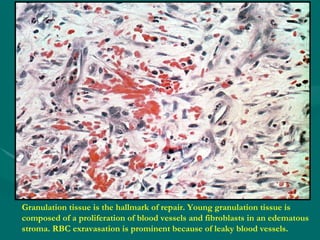 Inflammation Lab Slides | PPT