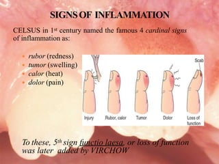 Inflammation milind | PPTX