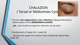 INFLAMMATION OF EYELID GLANDS ETIOLOGY CLINICAL FINDINGS AND MANAGEMENT ...
