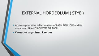 INFLAMMATION OF EYELID GLANDS ETIOLOGY CLINICAL FINDINGS AND MANAGEMENT ...