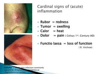 VASCULAR EVENTS OF INFLAMMATION - PATHOLOGY | PPT